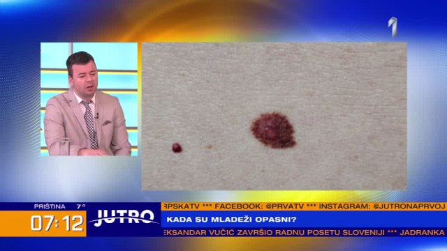 "Naduti" mladež, dvobojne promene, nejasan oblik i ivice - znakovi za ...